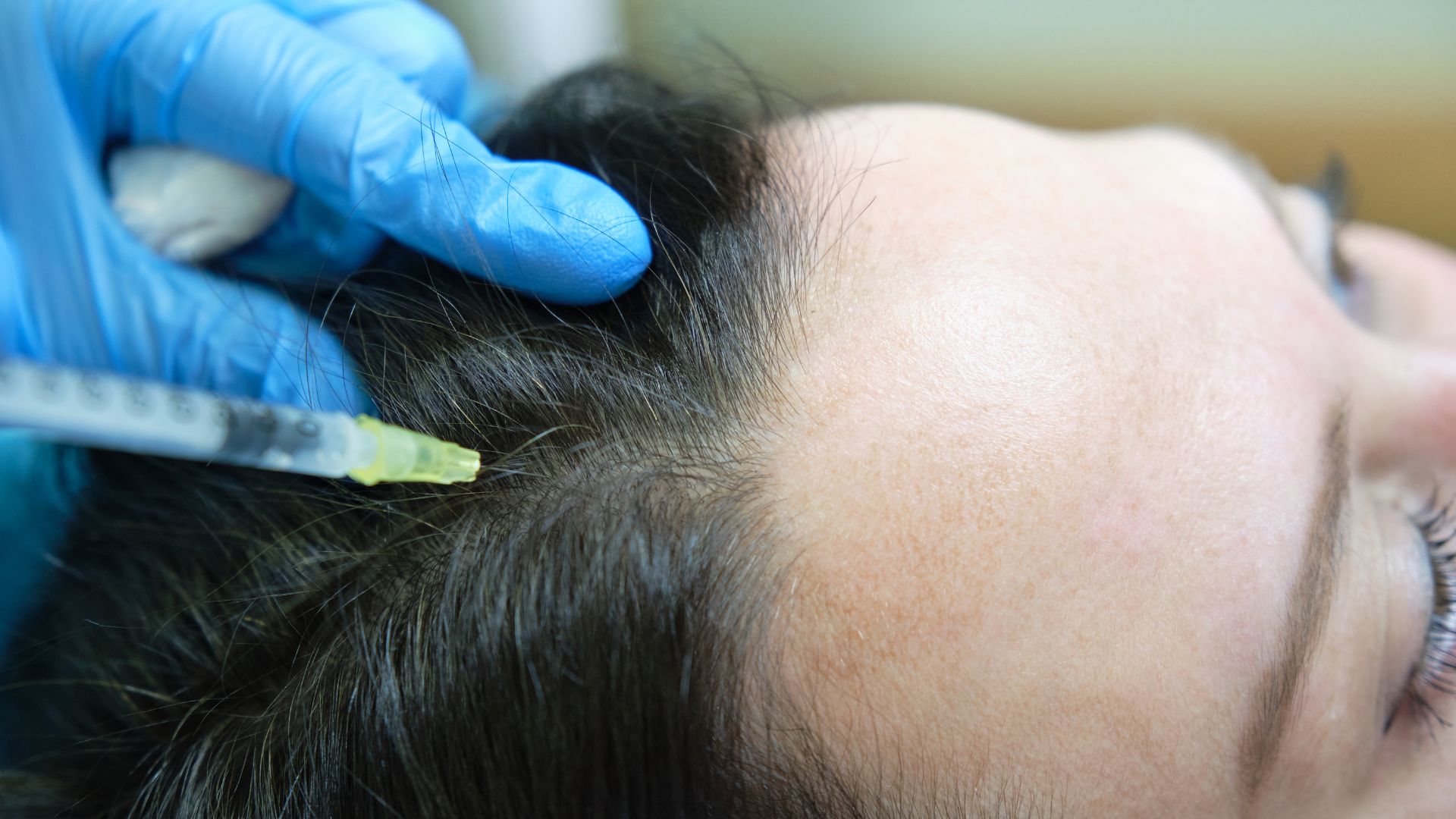 Non-Surgical Hair Restoration - BayMed Hair | St. Petersburg, FL Non-Surgical Hair Restoration - BayMed Hair | St. Petersburg, FL